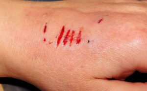 How to Stop a Dog From Biting: 6 Vet-Approved Tips & Advice | PangoVet